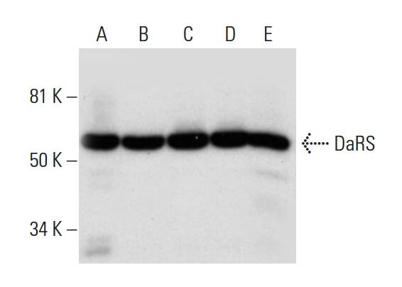Anti-DaRS Antibody (H-3) | SCBT - Santa Cruz Biotechnology