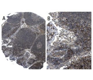 DAT Antibody (6-8D6) - Immunohistochemistry - Image 37966
