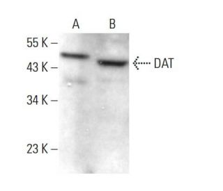 DAT Antibody (6-8D6) - Western Blotting - Image 379222