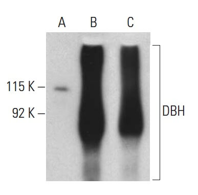 Anti-DBH Antibody (A-9) | SCBT - Santa Cruz Biotechnology