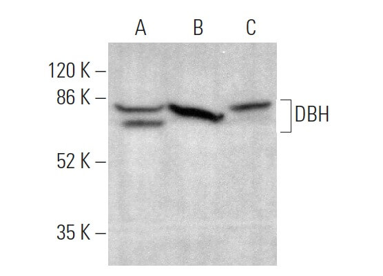 Anti-DBH Antibody (DBH 41) | SCBT - Santa Cruz Biotechnology