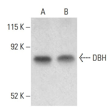 Anti-DBH Antibody (DBH 41) | SCBT - Santa Cruz Biotechnology