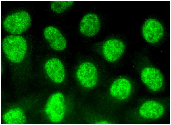 Anti-DcpS Antibody (A-12) | SCBT - Santa Cruz Biotechnology