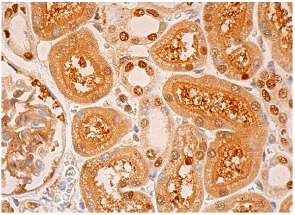 Anti-DcpS Antibody (A-12) | SCBT - Santa Cruz Biotechnology