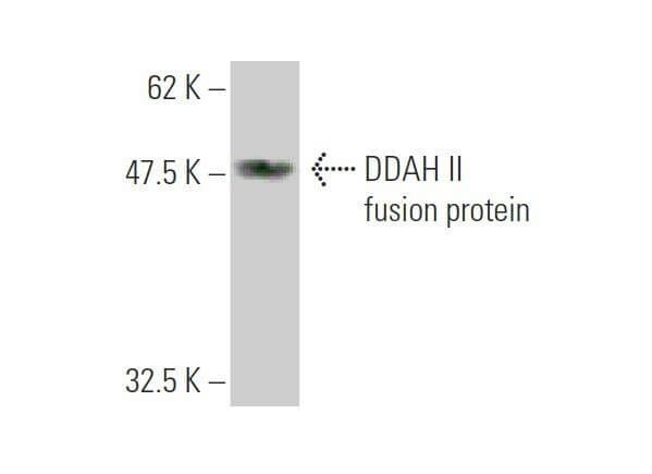 DDAH II Antibody (3E3) | SCBT - Santa Cruz Biotechnology