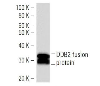 DDB2 Antibody (2246C4a) | SCBT - Santa Cruz Biotechnology