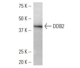 DDB2 Antibody (2246C4a) | SCBT - Santa Cruz Biotechnology