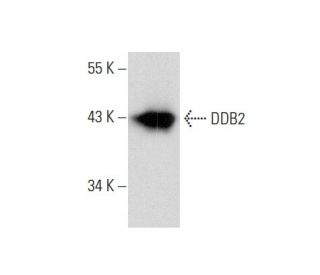 DDB2 Antibody (2246C4a) - Western Blotting - Image 139184
