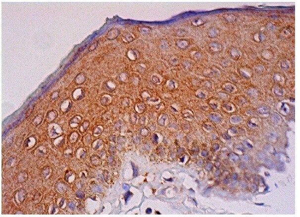 DDR2 Antibody (3B11E4) | SCBT - Santa Cruz Biotechnology