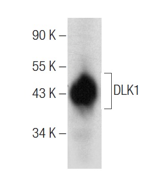 Anti-DLK1 Antibody (B-7) | SCBT - Santa Cruz Biotechnology