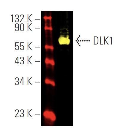Anti-DLK1 Antibody (B-7) | SCBT - Santa Cruz Biotechnology