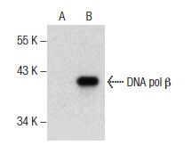 DNA pol β Antibody (D-11) | SCBT - Santa Cruz Biotechnology