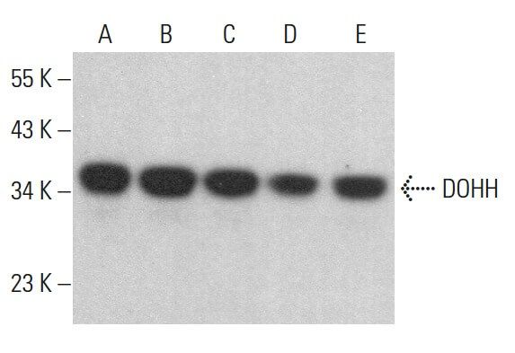 DOHH Antibody (E-2) | SCBT - Santa Cruz Biotechnology