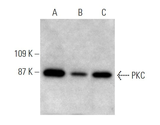 donkey anti-rabbit IgG-HRP Secondary Antibody | SCBT - Santa Cruz ...