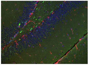 Doublecortin Antibody (C-18) | SCBT - Santa Cruz Biotechnology