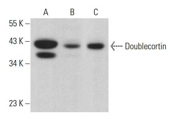 Doublecortin/DCX Antibody (E-5) | SCBT - Santa Cruz Biotechnology
