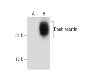 Doublecortin Antibody (E-6) - Western Blotting - Image 133966