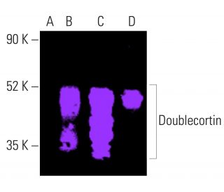 Doublecortin/DCX Antibody (E-6) - Western Blotting - Image 401807