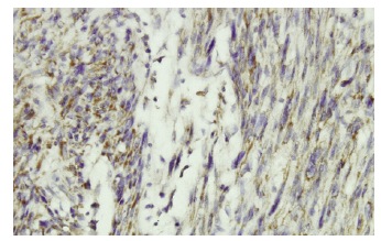 Anti-DRP1 Antibody (6Z-82) | SCBT - Santa Cruz Biotechnology