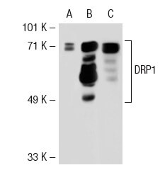Anti-DRP1 Antibody (6Z-82) | SCBT - Santa Cruz Biotechnology