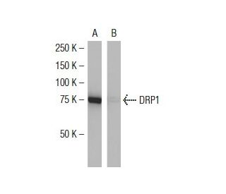 Anti-DRP1 Antibody (6Z-82) | SCBT - Santa Cruz Biotechnology