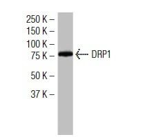 DRP1抗体 (6Z-82) | SCBT - Santa Cruz Biotechnology