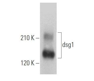 dsg1 Antibody (B-11) | SCBT - Santa Cruz Biotechnology