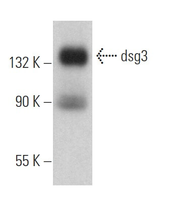 dsg3 Antibody (3G133) | SCBT - Santa Cruz Biotechnology