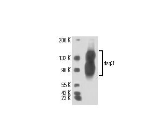 dsg3 Antibody (5H10) - Western Blotting - Image 16161