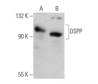 Anti-DSPP Antibody (LFMb-21) | SCBT - Santa Cruz Biotechnology