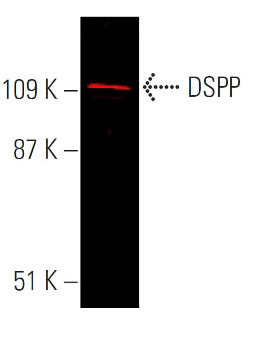 Anti-DSPP Antibody (LFMb-21) | SCBT - Santa Cruz Biotechnology