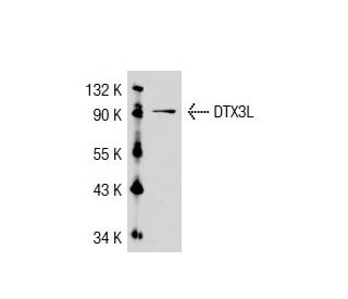 DTX3L Antibody (45.Y) - Western Blotting - Image 32645