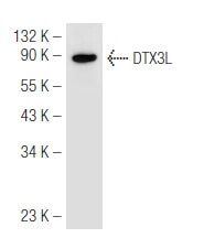 DTX3L Antibody (45.Y) | SCBT - Santa Cruz Biotechnology