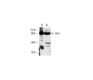 Dvl-1/Dishevelled 1/DVL1 Antibody (3F12) | SCBT - Santa Cruz Biotechnology