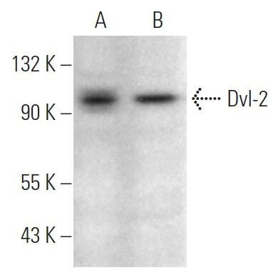 Dvl-2/Dishevelled 2/DVL2 Antibody (D-11) | SCBT - Santa Cruz Biotechnology
