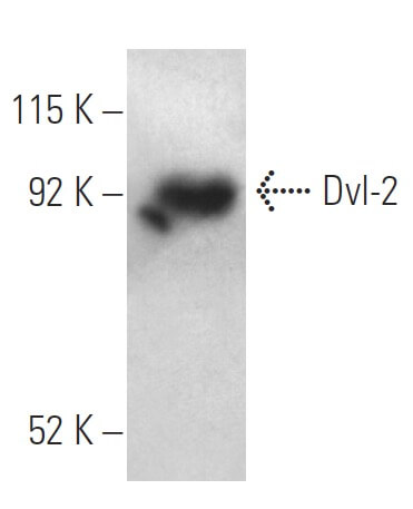 Anti-Dvl-2/Dishevelled 2/DVL2 Antibody (D-6) | SCBT - Santa Cruz ...