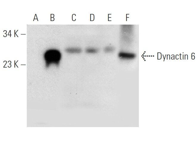 Dynactin 6 Antibody (A-2) | SCBT - Santa Cruz Biotechnology