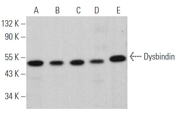 Dysbindin Antibody (D-8) | SCBT - Santa Cruz Biotechnology