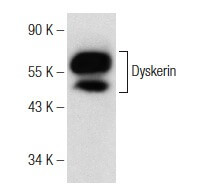 Anti-Dyskerin Antibody (H-3) | SCBT - Santa Cruz Biotechnology