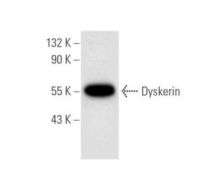 Anti-Dyskerin Antibody (H-3) | SCBT - Santa Cruz Biotechnology
