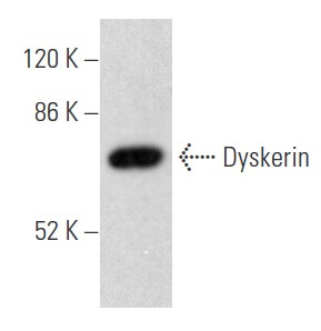 Anti-Dyskerin Antibody (H-3) | SCBT - Santa Cruz Biotechnology
