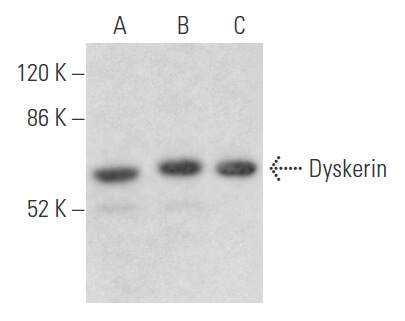 Anti-Dyskerin Antibody (H-3) | SCBT - Santa Cruz Biotechnology