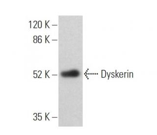 Anti-Dyskerin Antibody (H-3) | SCBT - Santa Cruz Biotechnology