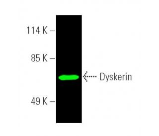 Anti-Dyskerin Antibody (H-3) | SCBT - Santa Cruz Biotechnology