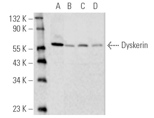 Anti-Dyskerin Antibody (H-3) | SCBT - Santa Cruz Biotechnology