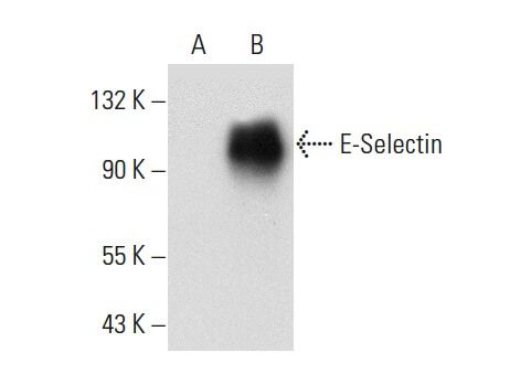 E-Selectin/CD62E/SELE抗体 (A-10) | SCBT - Santa Cruz Biotechnology