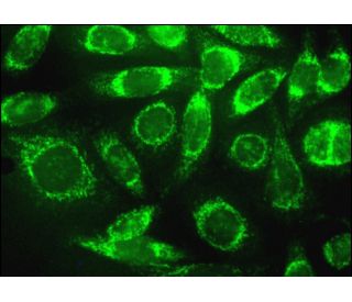 Anti-E3BP Antibody (H-6) | SCBT - Santa Cruz Biotechnology