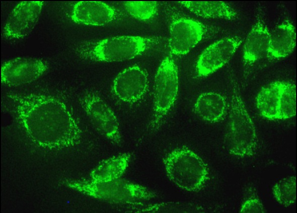 Anti-E3BP Antibody (H-6) | SCBT - Santa Cruz Biotechnology