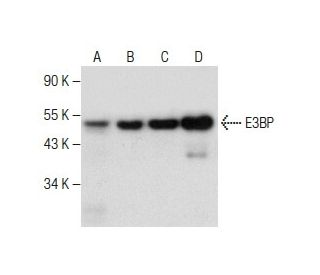 Anti-E3BP Antibody (H-6) | SCBT - Santa Cruz Biotechnology