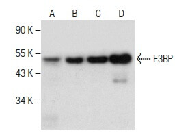 Anti-E3BP Antibody (H-6) | SCBT - Santa Cruz Biotechnology
